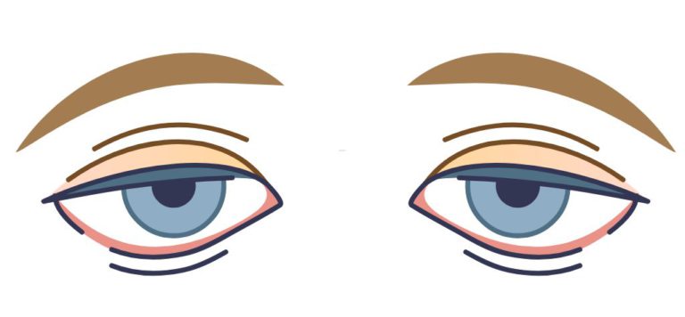 Why Do My Eyes Feel So Tired Even After Sleeping? The Hidden Cause ...
