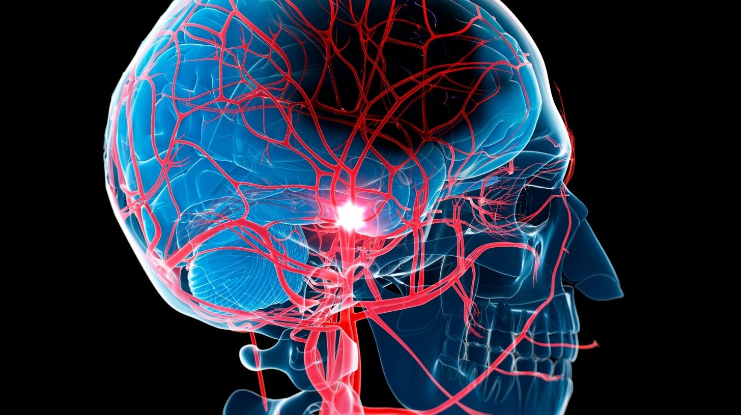 Eye Stroke: The Little-Known Emergency That Needs a 15-Minute Response ...
