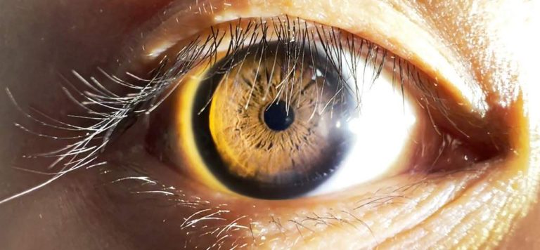 What Your Pupil Size Can Reveal About Your Eye Health - Daily EyewearDigest